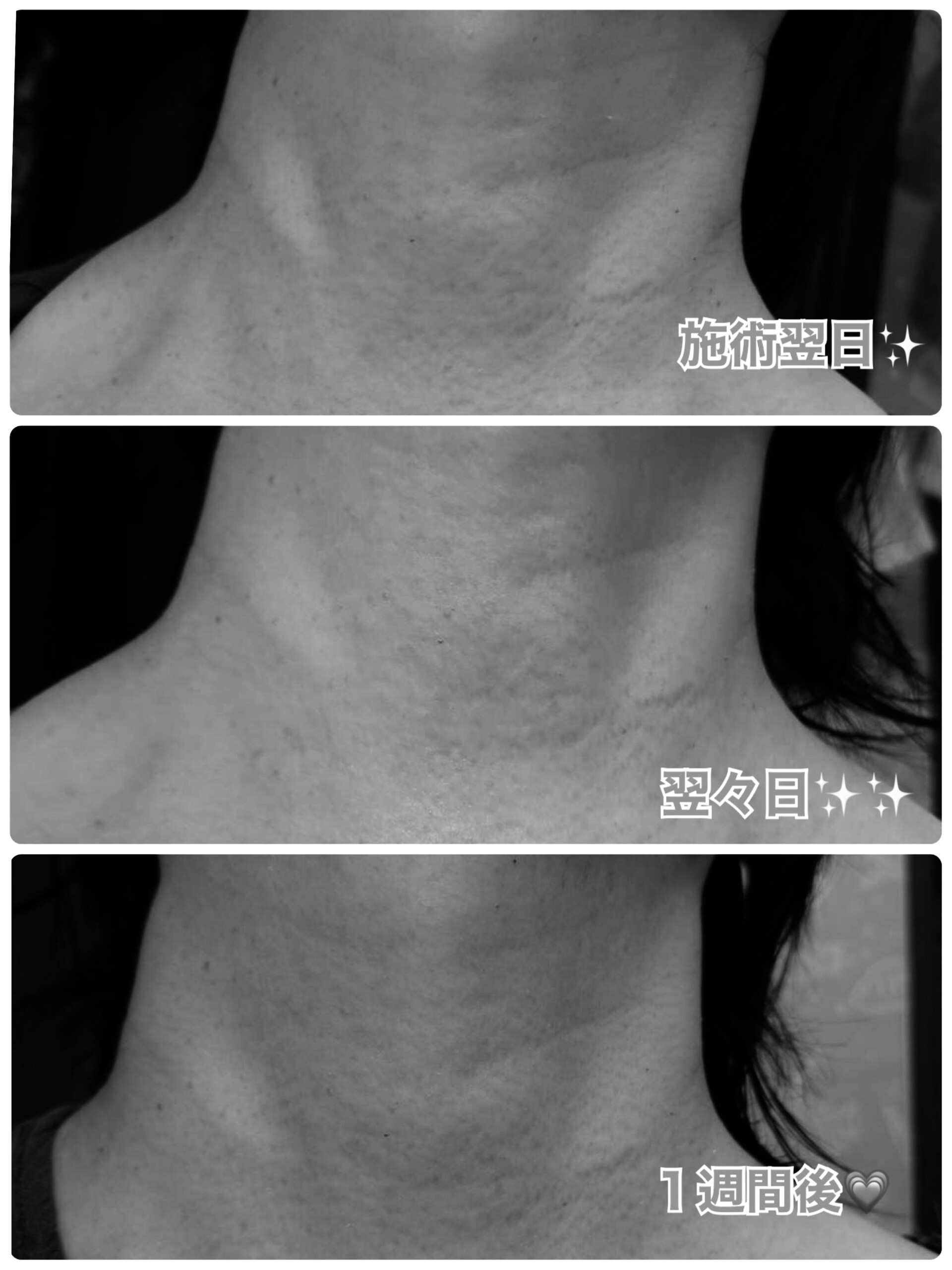 首までの美肌ケア「肌を育む」次世代ピーリング始まります - 札幌円山リラクゼーションエステ＆整体＆リフレクソロジー | パーソナルサロンCocoro(ココロ)